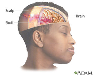 Blunt Force Head Trauma – Cause and Effect | Fort Worth Brain Injury ...