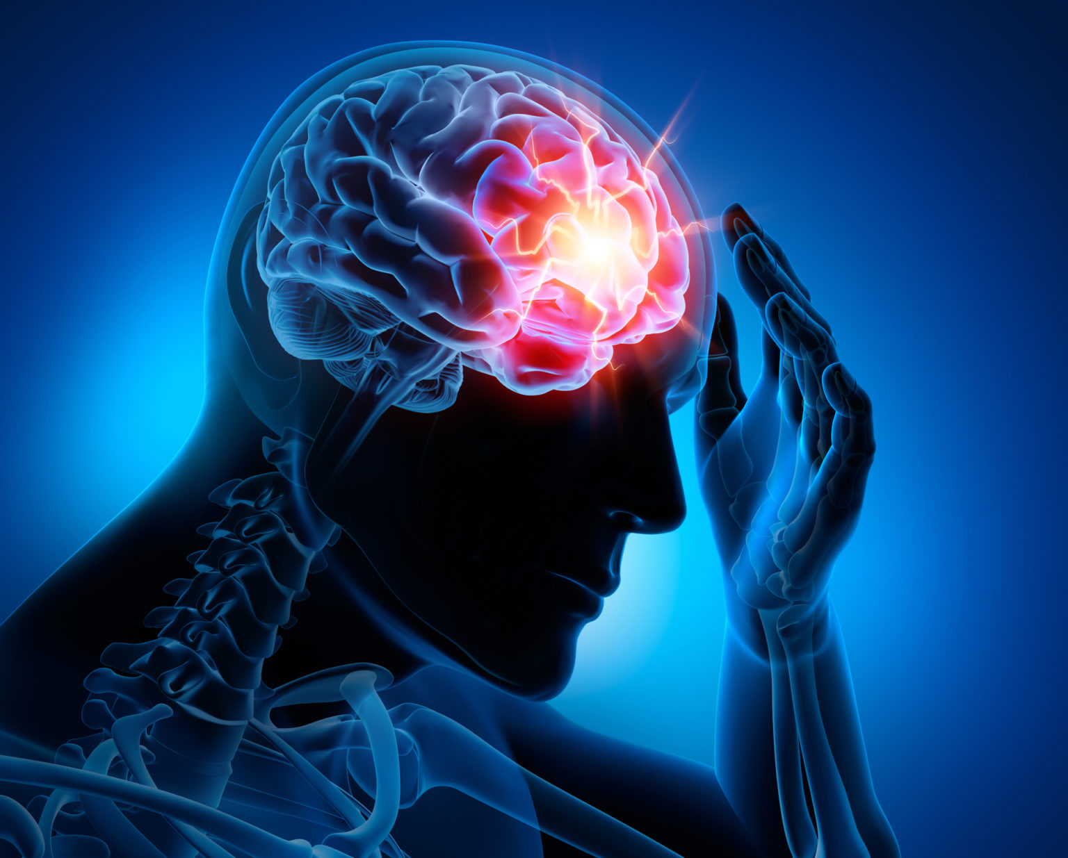Memory Loss After a Concussion - Stephens Law Firm, PLLC